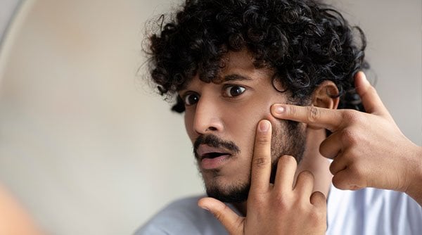 Beard Acne: Know its Causes and Treatment | Garnier India