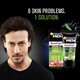 Garnier Acno Fight Cream | Buy Anti Acne Cream For Men